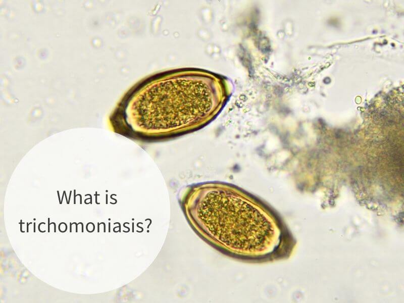 Trichomoniasis - Everything you need to know | STDWatch.com